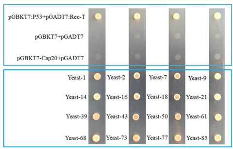 科研显微镜 的想法: 酵母双杂交的结果看不懂？进来看看这张图。 这张图中：pGBKT7:P53 + pGADT7:Rec-T为阳性对照；PGBKT7 + PGADT7为阴性对照（从这个图我们就 ...