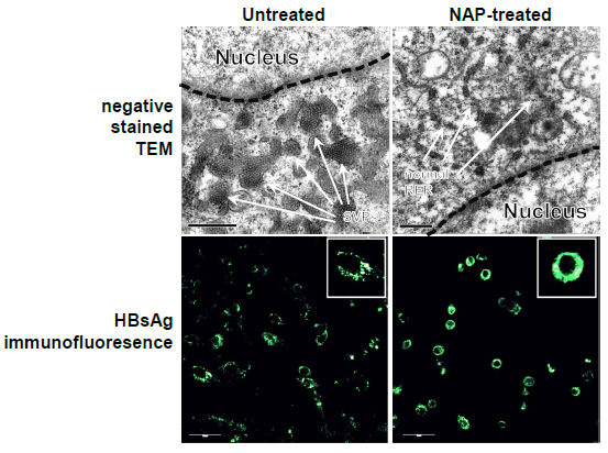 慢乙肝治疗新动向：REP 2139-Ca - 知乎
