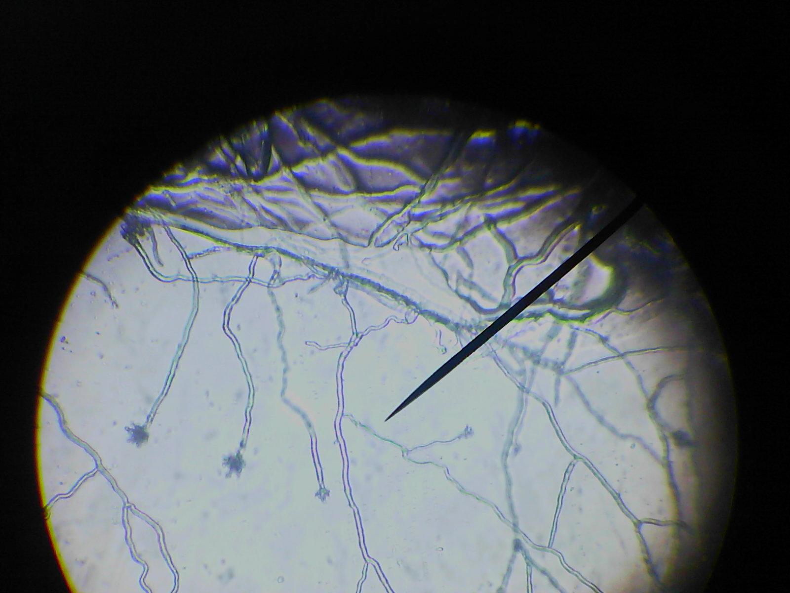 如何在显微镜下观察霉菌？ - 知乎