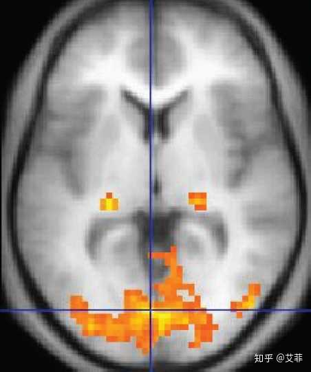 应用 fMRI（功能磁共振）技术研究神经环路机制需要掌握哪些基础知识？ - 知乎