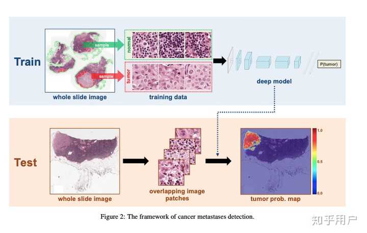 Unet神经网络为什么会在医学图像分割表现好？ - 知乎
