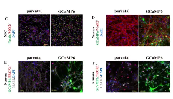基因修饰神经干细胞-公司新闻-武汉枢密脑科学技术有限公司
