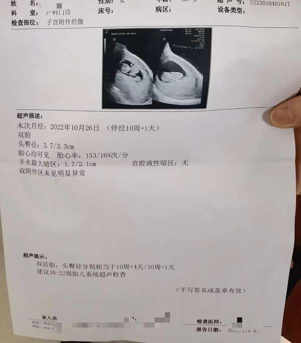 柚子 的想法 33岁备孕一胎 周期27 34天比较规律 第一 知乎