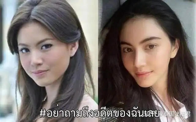 Hoorne Davika Plastic Surgery