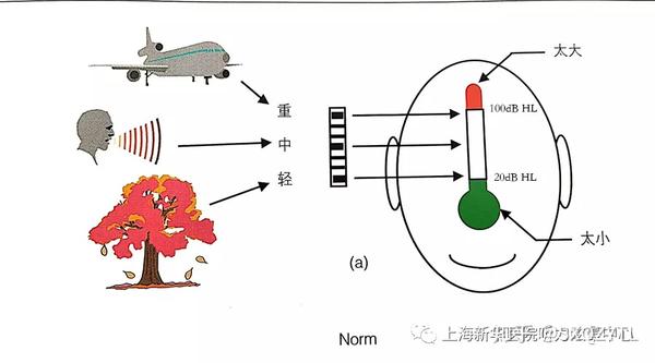 你有“小声听不见，大声有嫌吵”的问题吗？ - 知乎