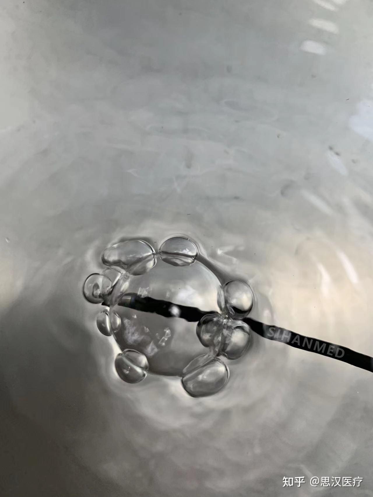 泌尿外科治疗中对于输尿管镜技术的研究及STORZ 11278VS 电子输尿管镜 维修案例 - 知乎