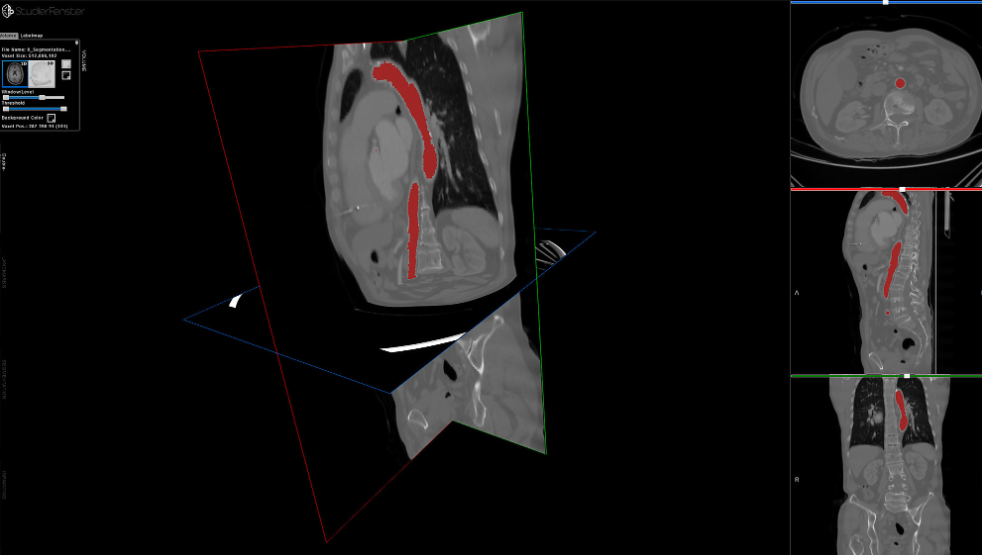 SEG.A. 数据集介绍 - 知乎