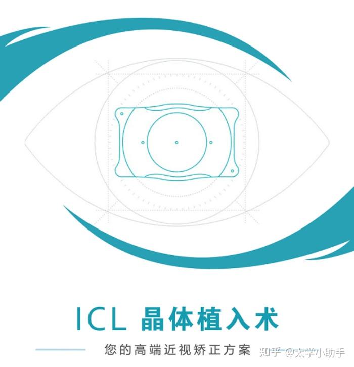 杭州太学眼科ICL晶体植入手术：高清可逆的个性化定制近视手术 - 知乎
