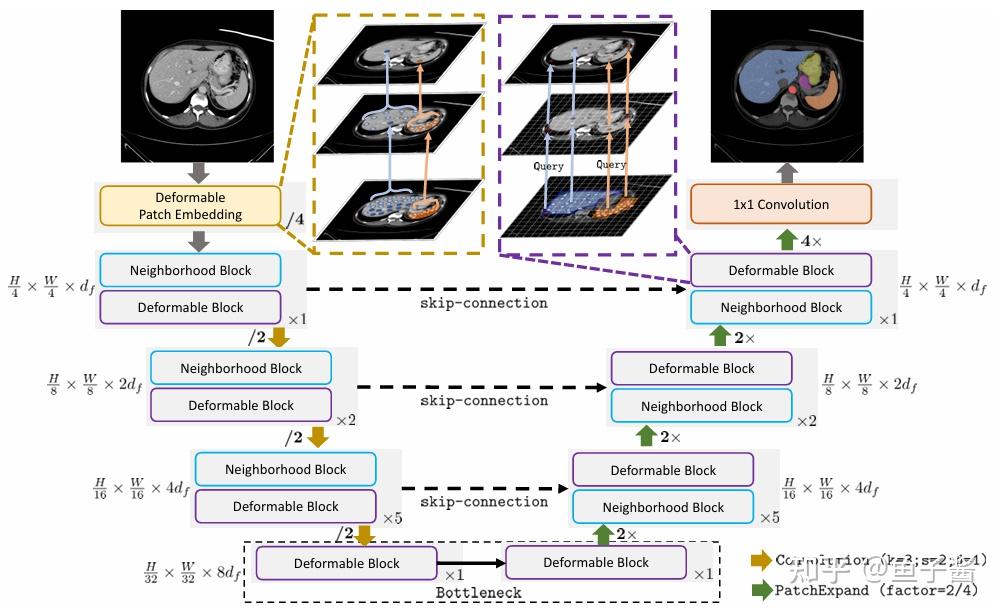 Transformer+UNet到底是谁想出来的点子！用来创新真的太绝了！ - 知乎