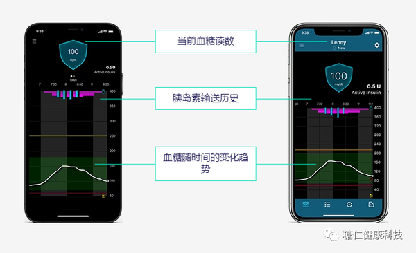 自动胰岛素泵天花板！Medtronic MiniMed™ 780G系统！ - 知乎