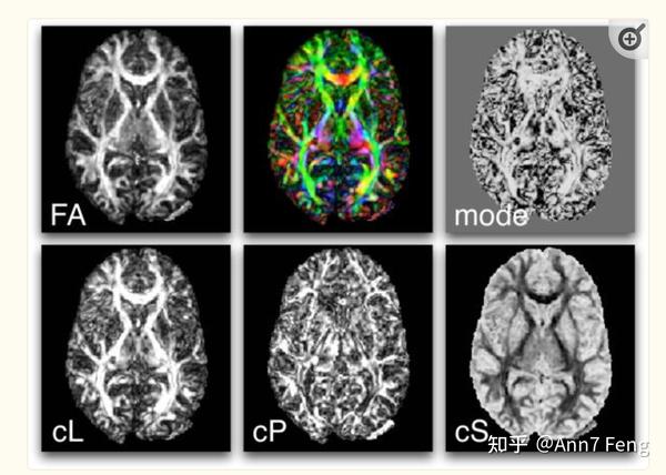 【Medical Imaging 01】 Diffusion Tensor Imaging (DTI) - 知乎