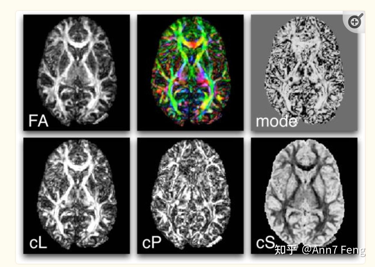 【Medical Imaging 01】 Diffusion Tensor Imaging (DTI) - 知乎