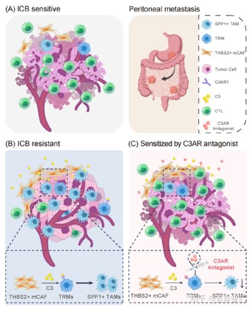 科研最前沿 | 单细胞测序揭示胃癌腹膜转移中CAFs与巨噬细胞互作影响ICB反应的机制 - 知乎