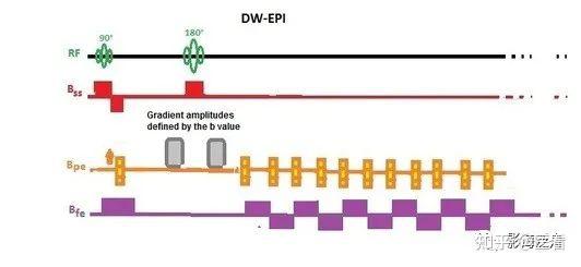 一个颅脑病例，带大家重新认识DWI序列 - 知乎