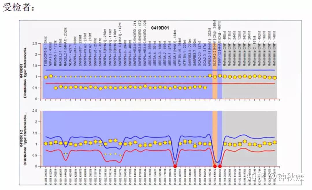 Prader-Willi(PWS)综合征的基因检测 - 知乎