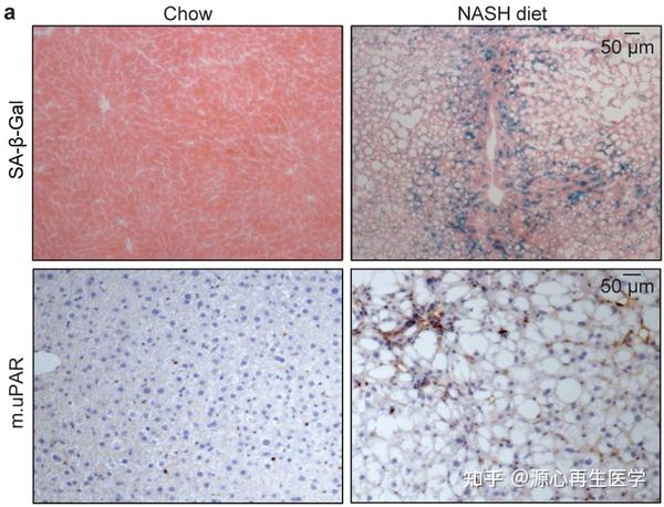 Nature丨“返老还童”新突破：uPAR助力CAR-T提高抗衰老效果 - 知乎