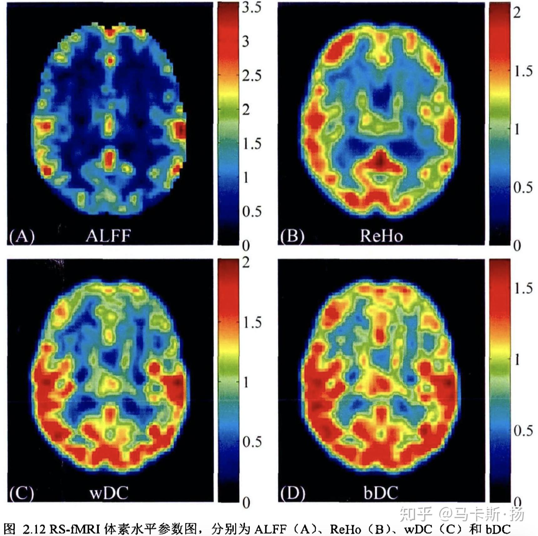 fMRI_名词解释 _1 - 知乎