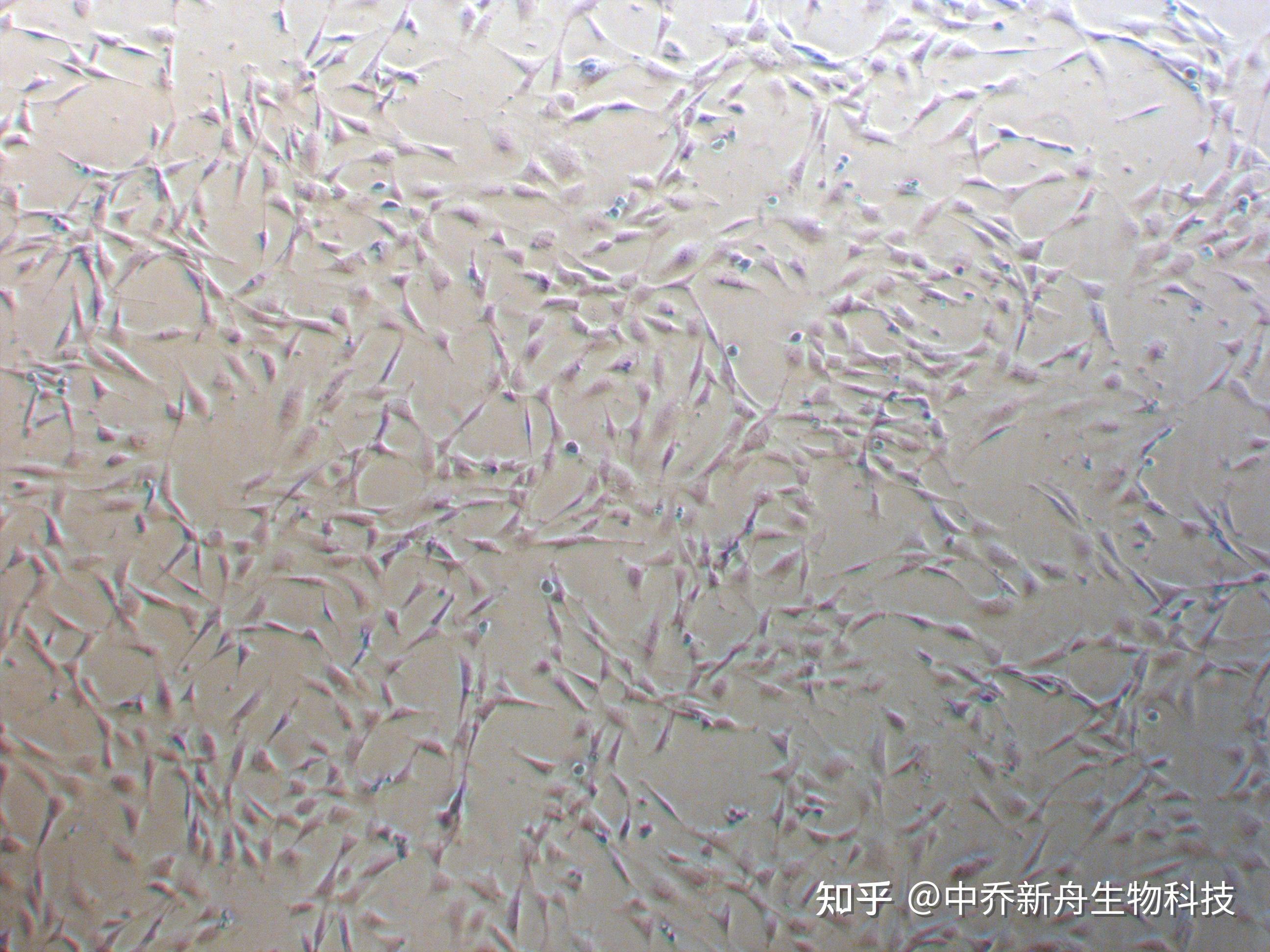 【细胞课堂】3T3-L1细胞培养及成脂诱导分化实验 - 知乎