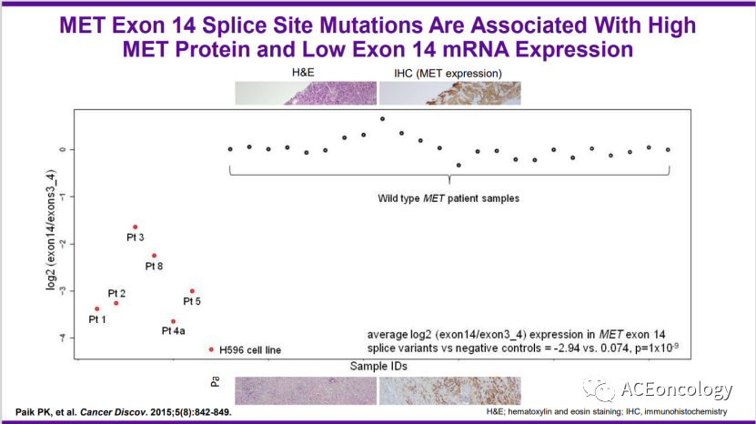 大咖说｜Paul Paik 教授谈 MET 14 外显子跳跃突变非小细胞肺癌（NSCLC）的治疗策略 - 知乎