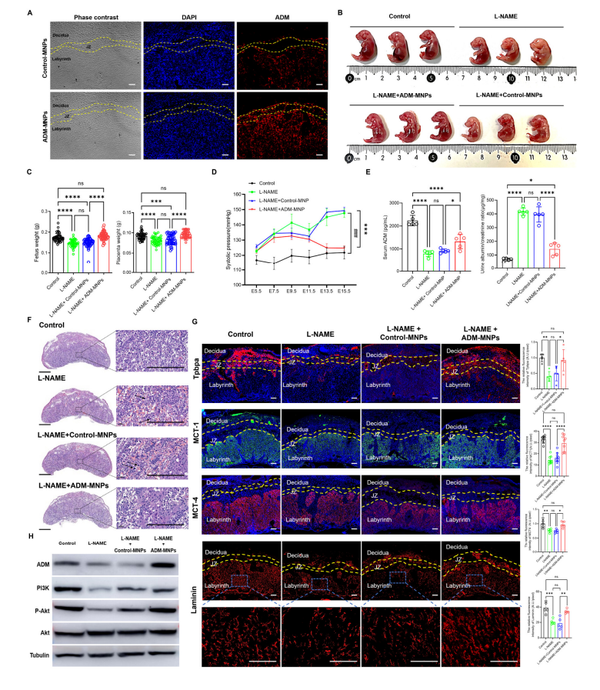 Sci. Adv. | Stereo-seq揭示肾上腺髓质素在胎盘发育和早发型子痫前期发病机制中的作用 - 知乎
