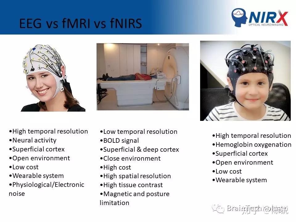 EEG vs MRI vs fMRI vs fNIRS - 知乎