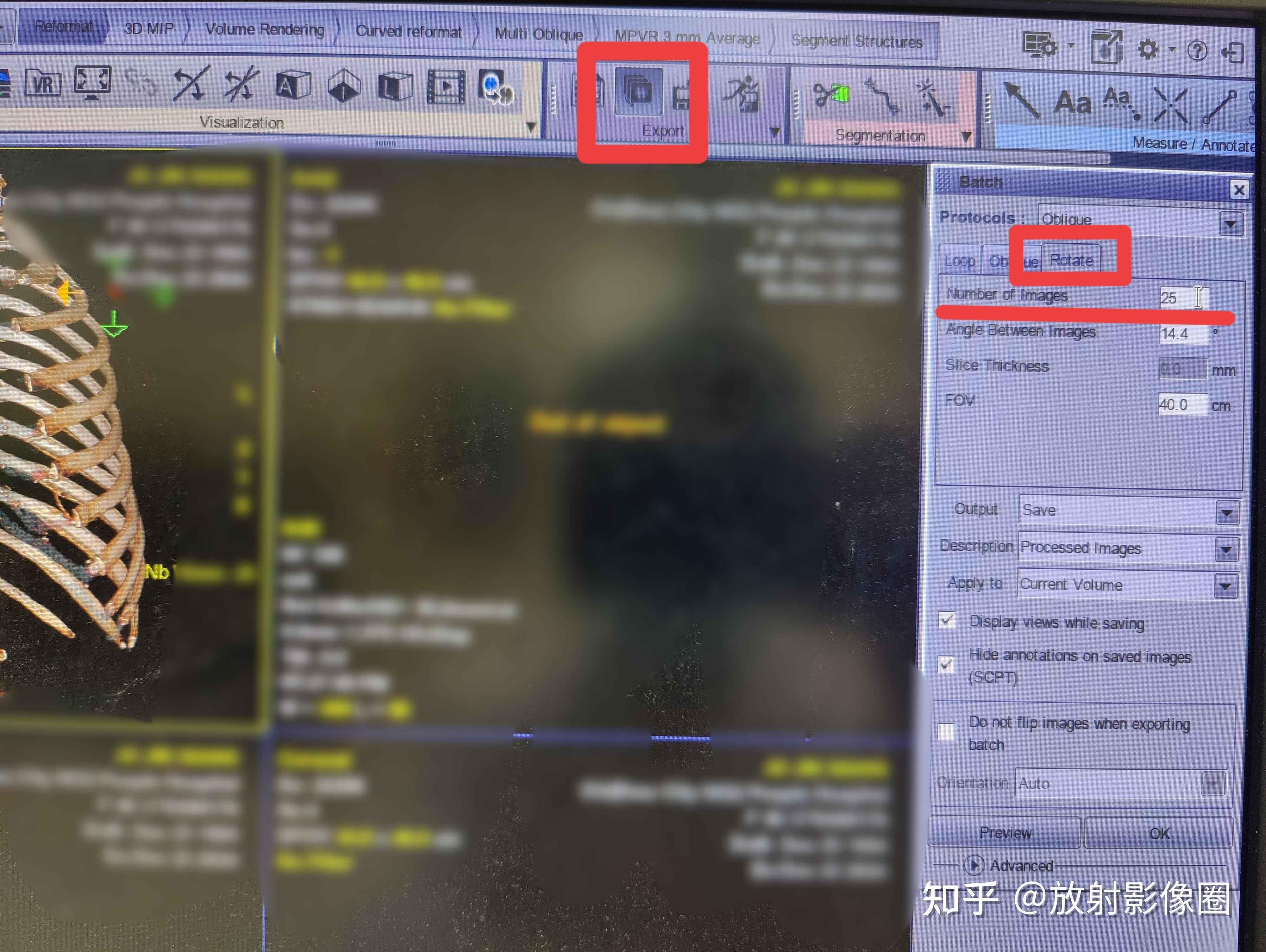 浅谈CT三维重建的操作方法 - 知乎
