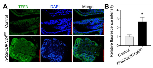 STM | 胃食道癌三维器官模型研究胃食管连接部（GEJ）癌症 - 知乎