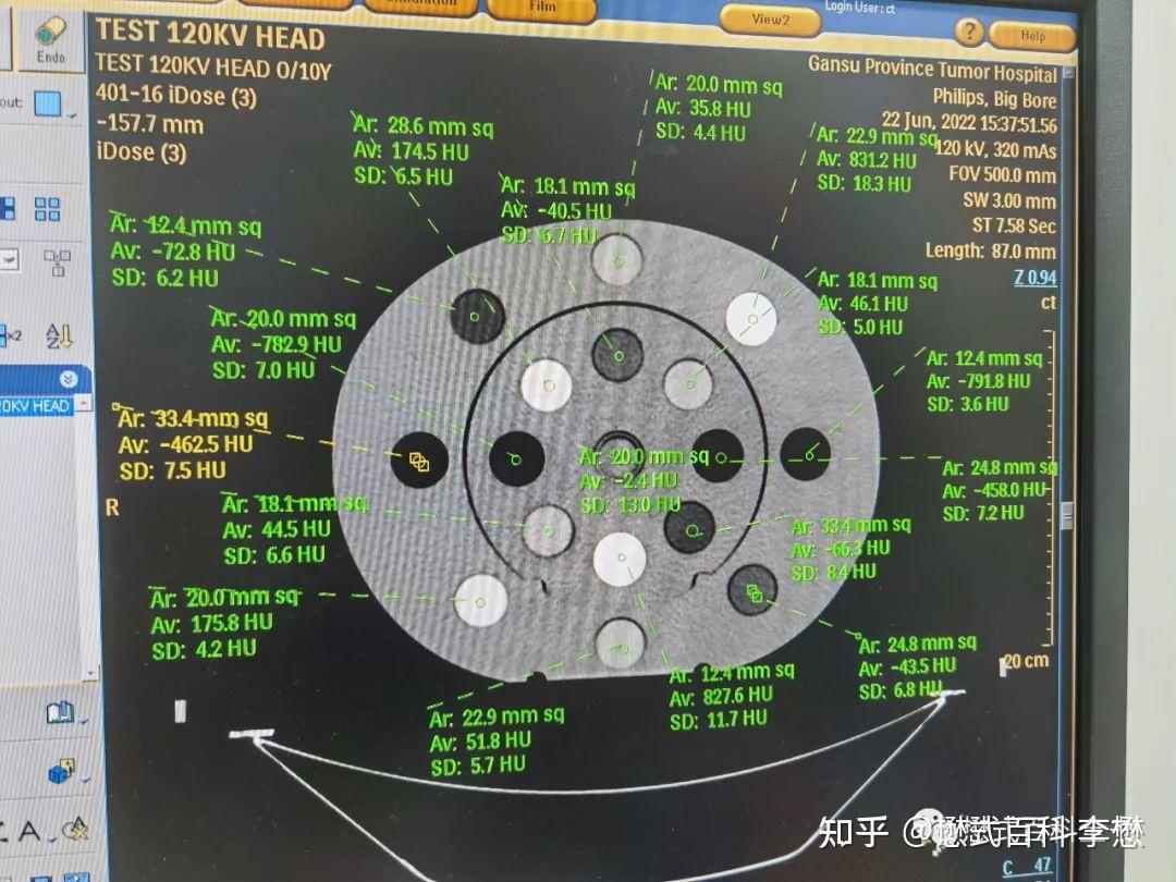 CT值与ppm - 知乎