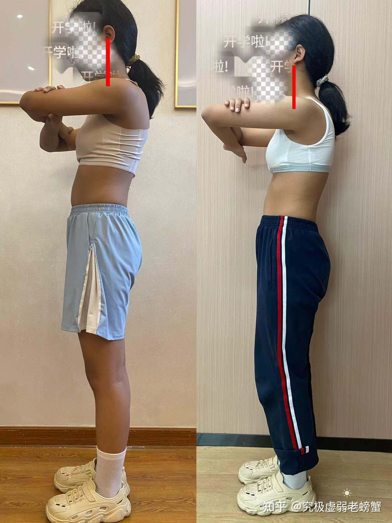 PRI FLM和Cervical组合高效改善体态 - 知乎