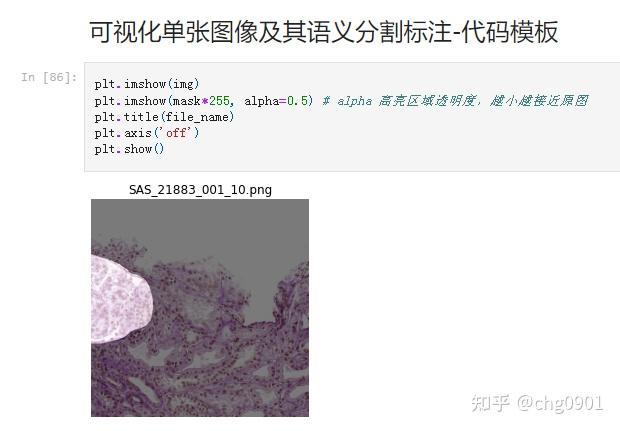 Mmsegmentation Openmmlab 实战营打卡7 知乎