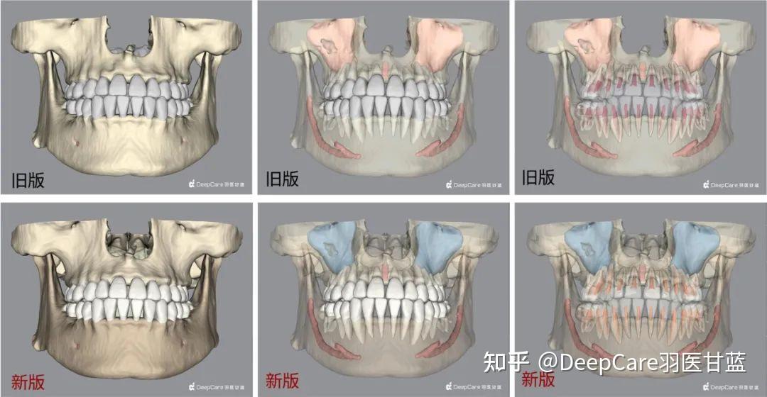 DeepCare羽医甘蓝CBCT最新AI功能登陆IDS 2025，全球开放试用！ - 知乎