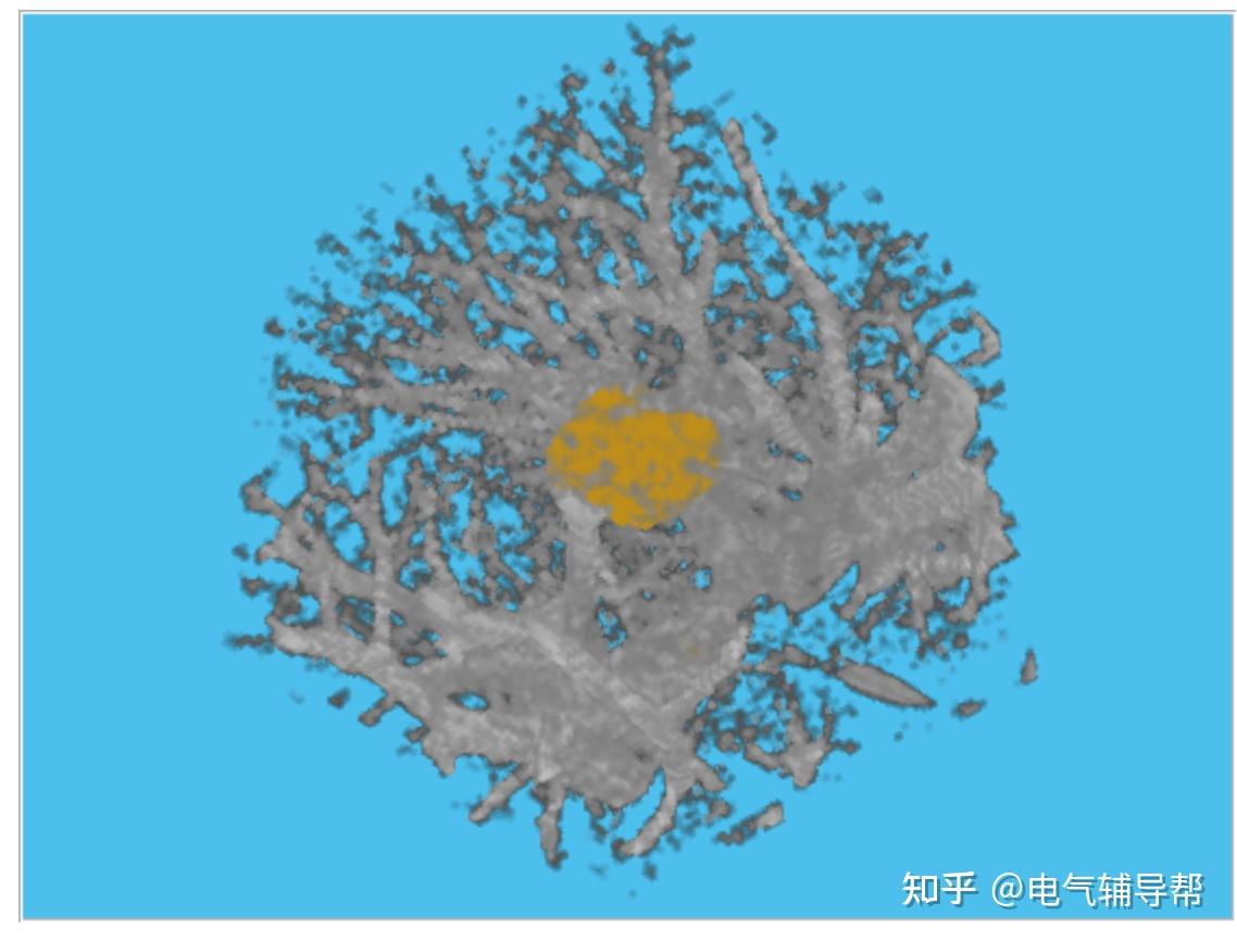 【3-D深度学习：肺肿瘤分割】创建和训练 V-Net 神经网络，并从 3D 医学图像中对肺肿瘤进行语义分割研究（Matlab代码实现） - 知乎