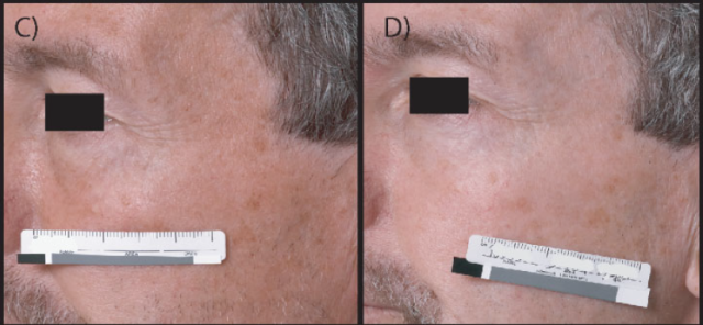 Rox Anderson：从激光医学之父到最成功的医生创业者 - 知乎