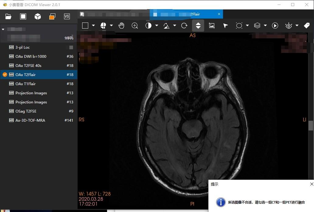 DICOM 图像浏览器和影像科研平台推荐（附 Radiant Viewer、3D Slicer 安装包） - 知乎