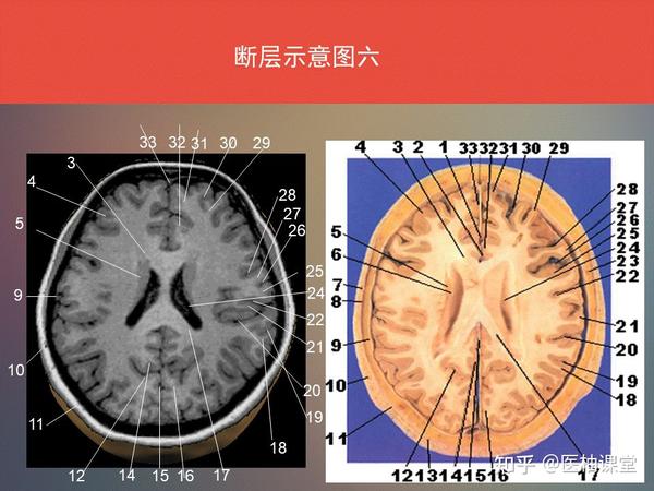 脑功能区及解剖学定位 - 知乎