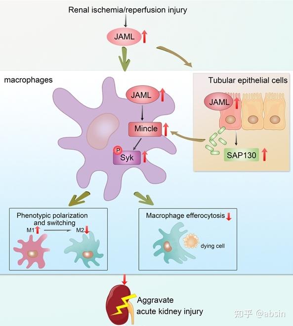 多色文献分享：连接黏附分子样蛋白JAML促进急性肾损伤的机制 - 知乎