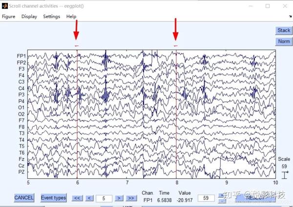 如何利用EEGlab工具包在EEG数据中手动插入Marker？ - 知乎