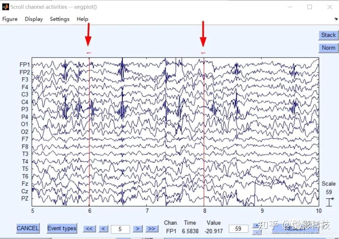 如何利用EEGlab工具包在EEG数据中手动插入Marker？ - 知乎