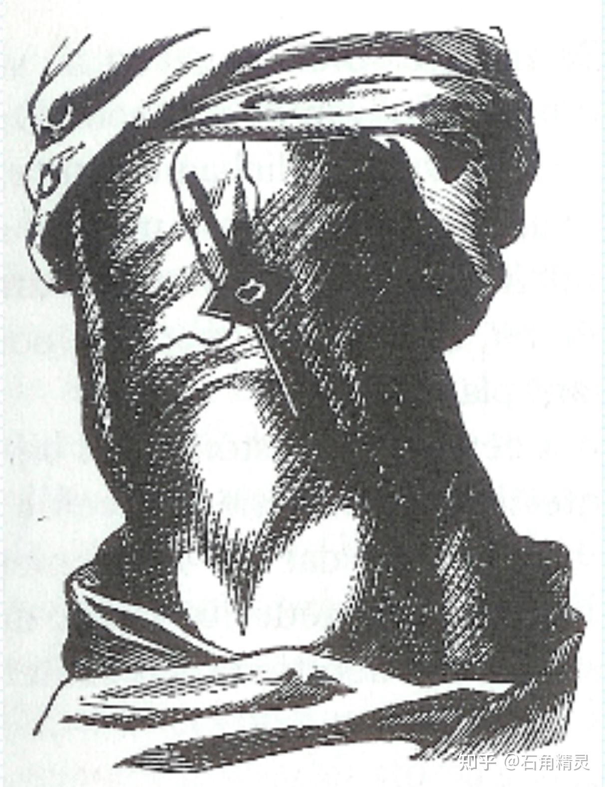 泌尿传奇：肠道造口的历史 - 知乎