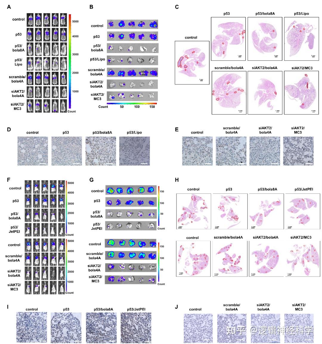 PANS︱彭玲/刘潇璇团队基于bola型两亲性树形分子可实现核酸药物选择性和适应性递送 - 知乎