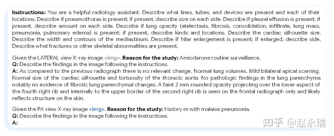 医学报告生成大模型总结梳理 - 知乎