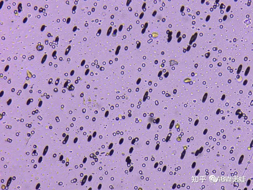 Transwell侵袭实验——熟练篇 - 知乎