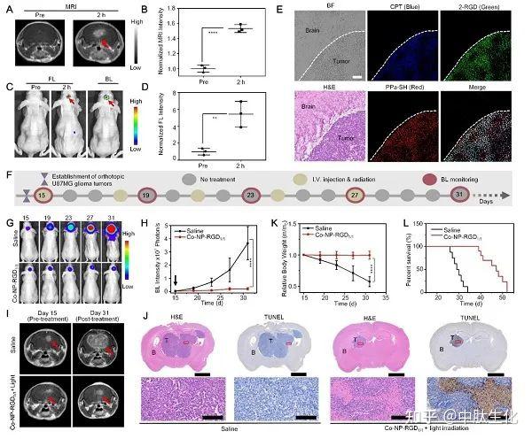 ACS Nano：叶德举/柳红团队开发用于脑胶质瘤的成像与治疗的纳米探针 - 知乎