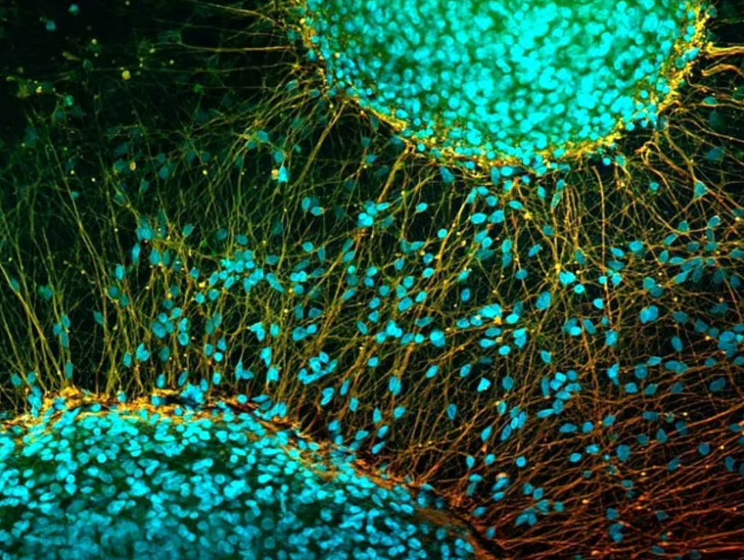 Nature重磅：瘫痪男子输注200万iPSC细胞后重新站立，我国多项iPSC细胞疗法获批IND - 知乎