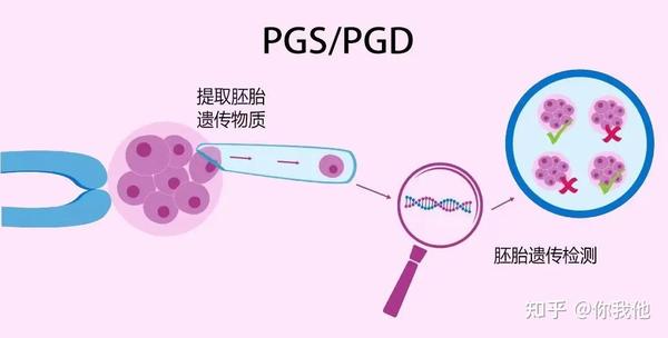 第三代试管PGD技术指的是什么？ - 知乎