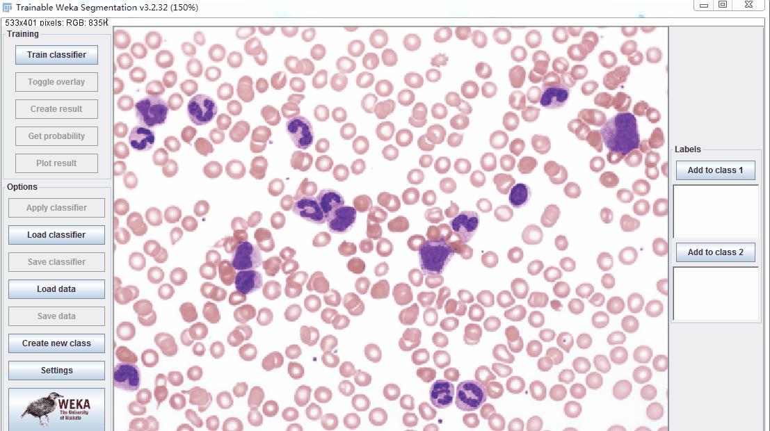 ImageJ实用技巧——基于机器学习的自动细胞分割(插件篇) - 知乎