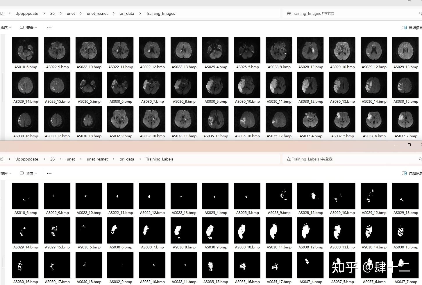 Unet系列模型在自己医学数据集上的使用（unet、unet++、r2net、attention unet以及unet的改进） - 知乎