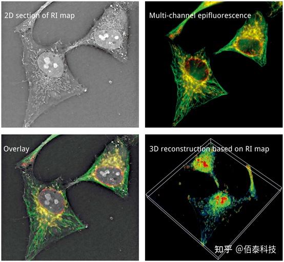 【Nanolive应用案例】3.使用细胞全息3D成像技术观察特异性细胞导管诱导干细胞的自我组织 - 知乎