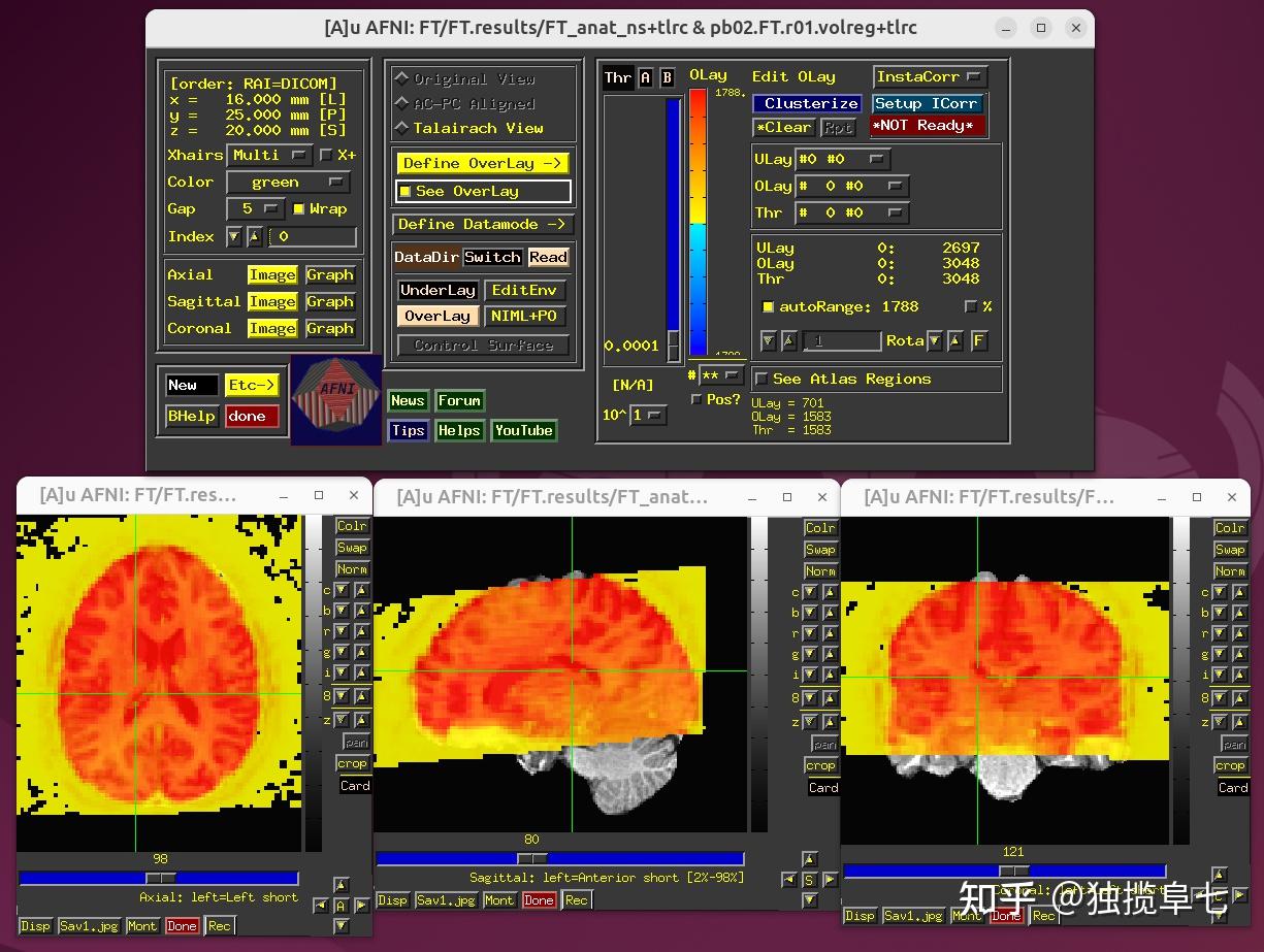 用AFNI处理fMRI数据 - 知乎