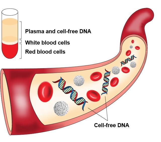 游离DNA（cfDNA）-新型标志物 - 知乎